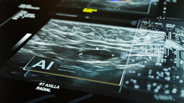 New AI tool classifies brain tumors using images of tumor slides ... New AI tool classifies brain tumors using images of tumor slides ...